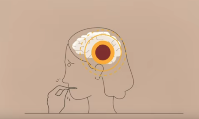 La alimentación puede revertir los efectos del estrés en el cerebro ...